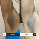 Magic Eraser Dark Spot Cream – Glo Melanin