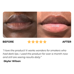 Turmeric and Lemon Lip Balm (for Dark Lips) – Glo Melanin